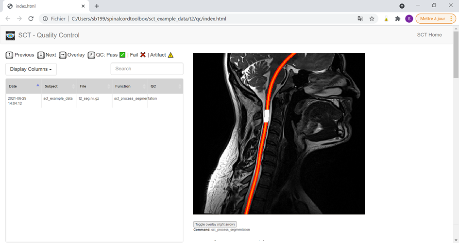 Add visualization of the centerline smoothed in RL direction in `sct_qc` · Issue #3431 ...