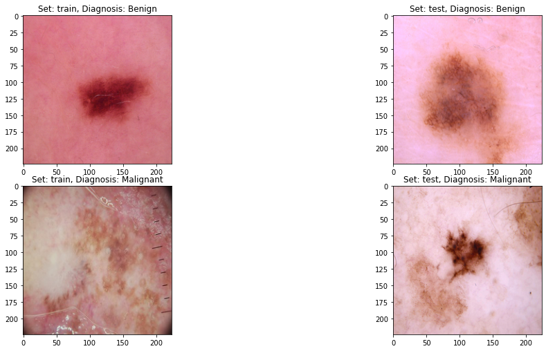 GitHub - samtuleen/skin-cancer-image-classification