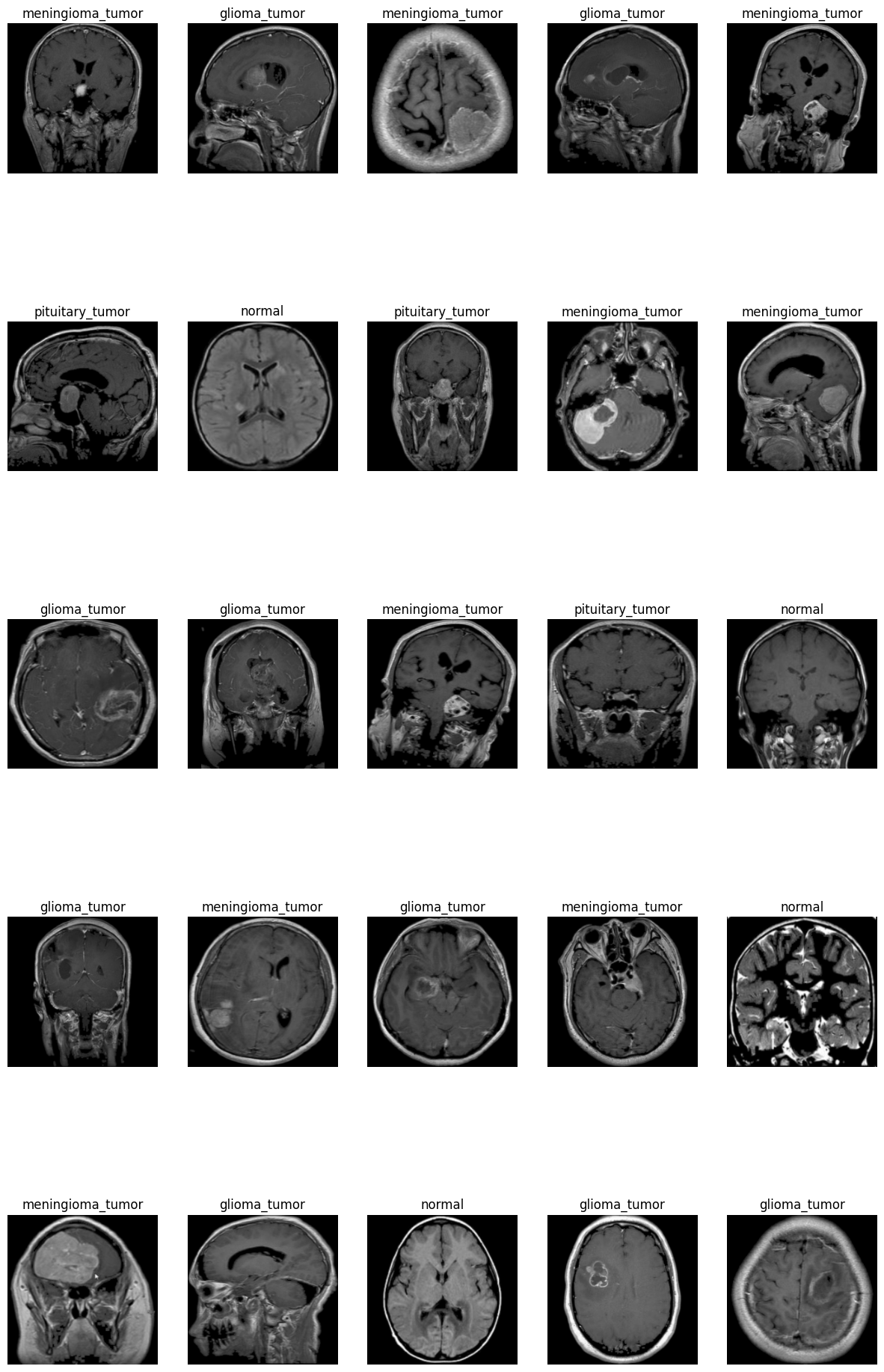 GitHub - MojtabaZarreh/Brain-tumors-Classification: Brain image classification with CNN