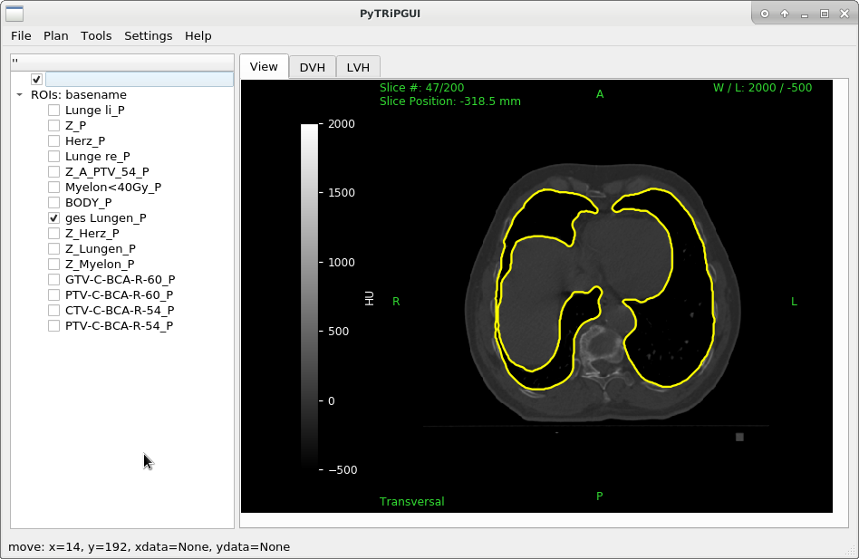 Only one contour per slice · Issue #465 · pytrip/pytrip · GitHub