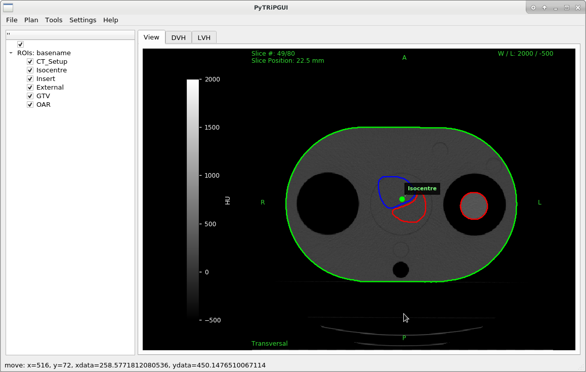 Only one contour per slice · Issue #465 · pytrip/pytrip · GitHub