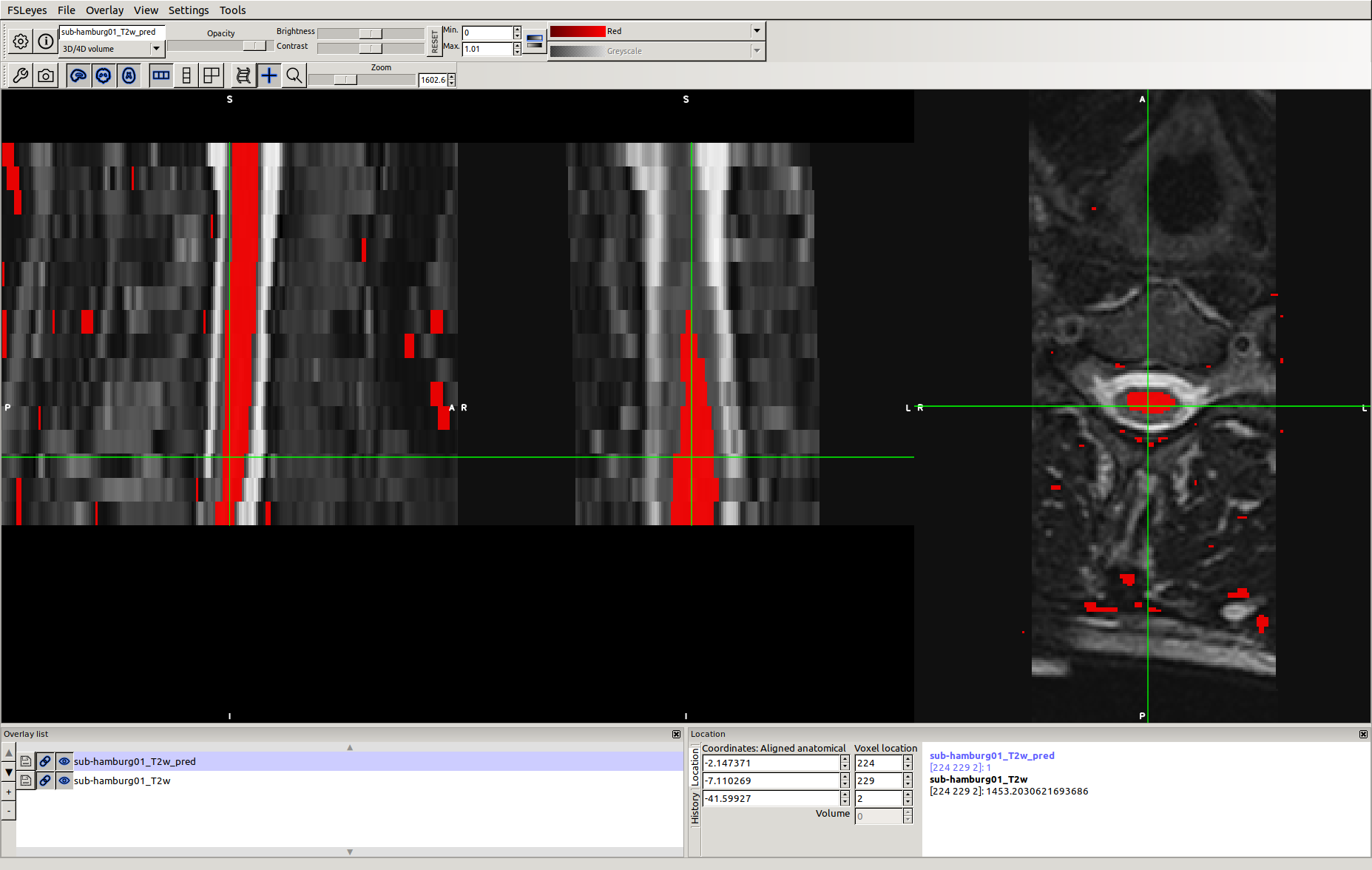 issue with one-class segmentation tutorial · Issue #448 · ivadomed ...