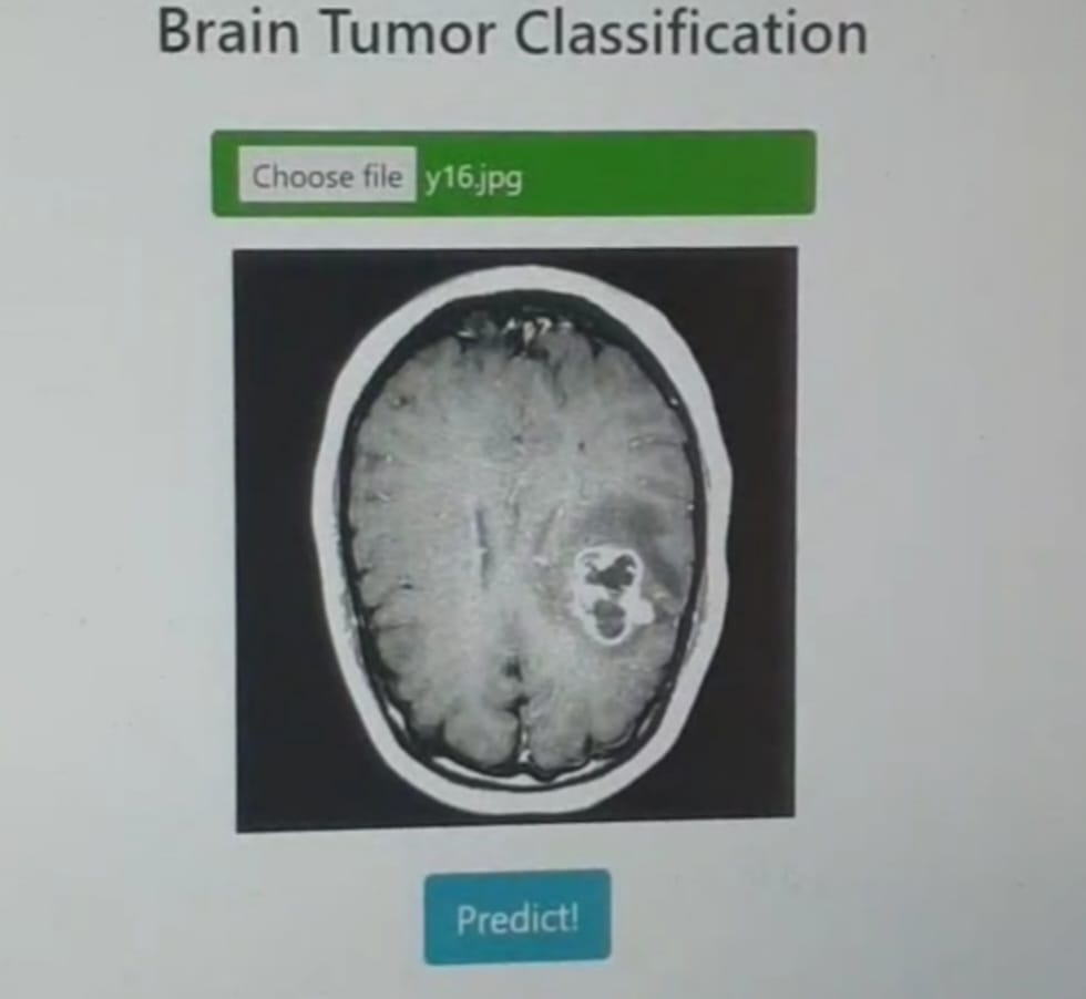 GitHub - jubaljacob/Brain_tumor_detection: # Brain_tumour_detection A ...