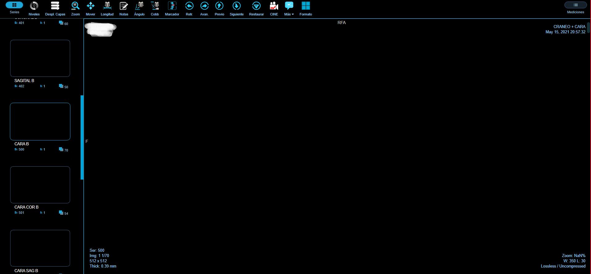 Images are displayed in black in OHIF viewer 2.0. Unsupported orthanc versions · Issue #2513 ...