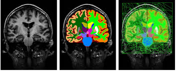GitHub - AviKhandelwal/Biomedical-Segmentation-of-Brain-MRI-scans