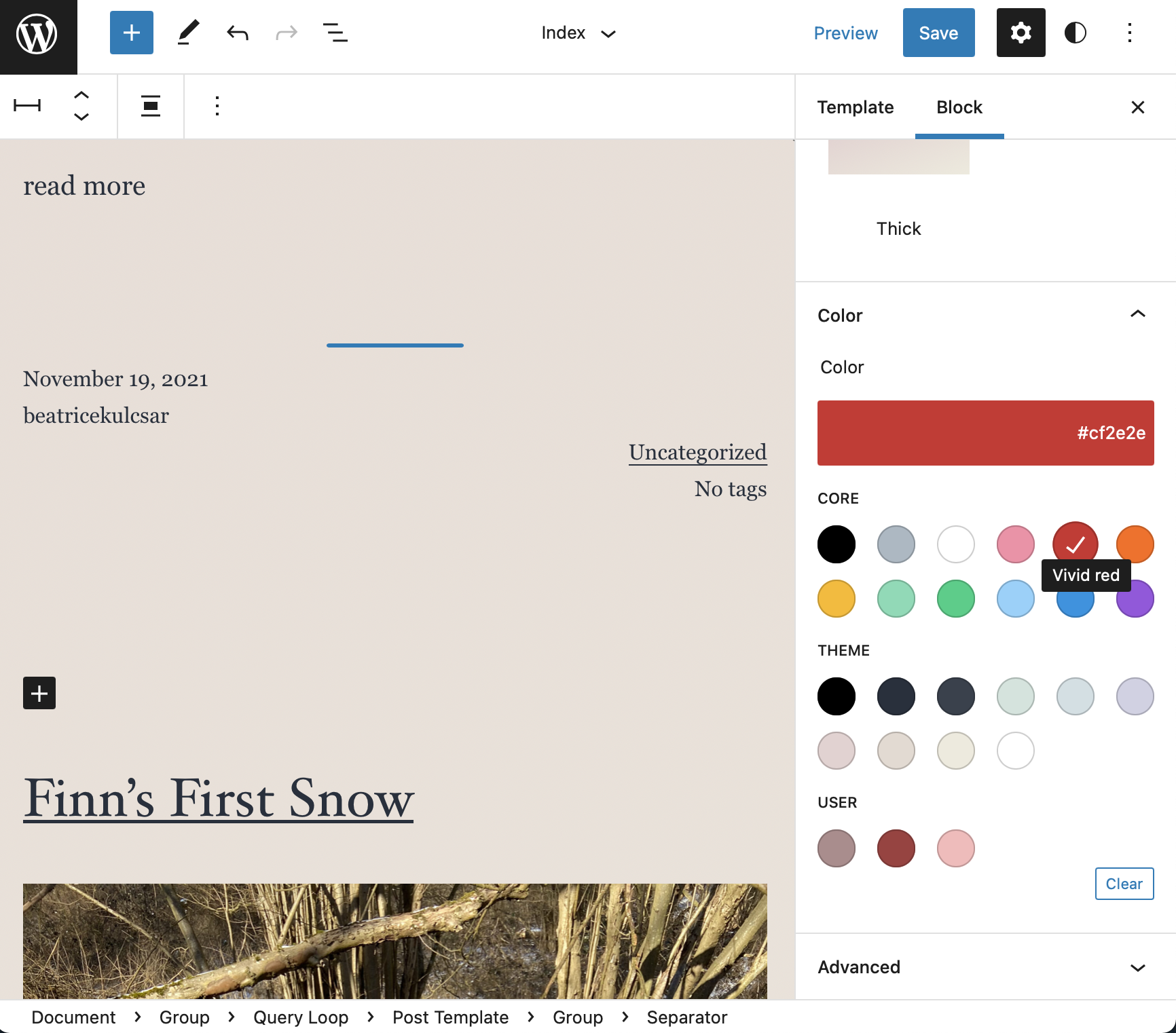 Unable to see Separator Color while selected · Issue #36730 · WordPress/gutenberg · GitHub
