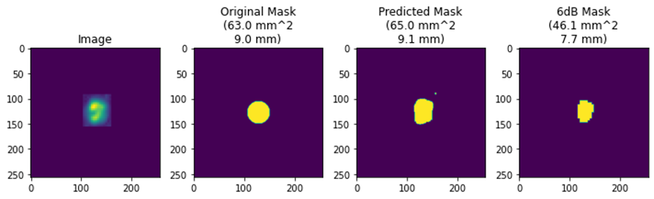 GitHub - shaunmcknight/UT-UNet: UNet segmentation model for UT