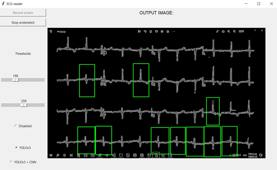 GitHub - AbiudSM/Electrocardiogram-Reader: Artificial intelligence ...