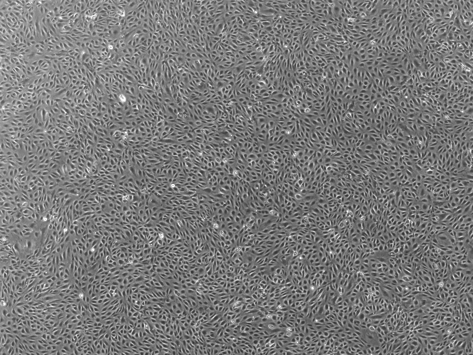 Github Elithb Cell Detection M1 Project