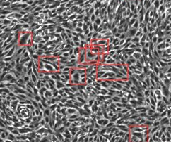 GitHub - elithb/Cell_Detection: M1 Project