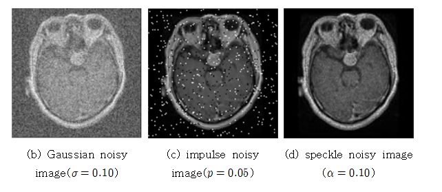 Github Eonseungseongimage Denoising With Cddae Convolutional Dual Decoder Autoencoder를 사용한