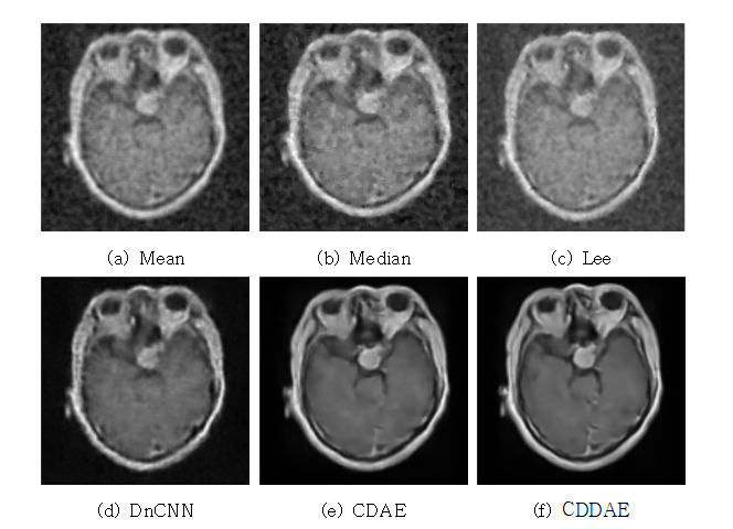 GitHub - EonSeungSeong/Image-Denoising-With-CDDAE: Convolutional Dual-Decoder AutoEncoder를 사용한 ...