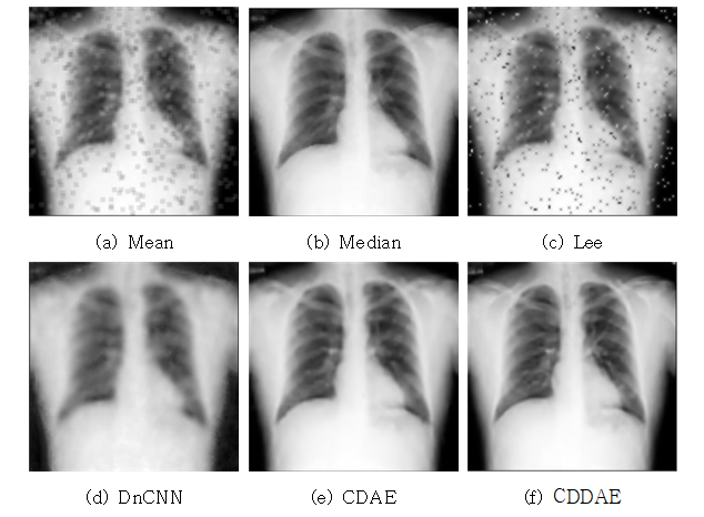 GitHub - EonSeungSeong/Image-Denoising-With-CDDAE: Convolutional Dual-Decoder AutoEncoder를 사용한 ...