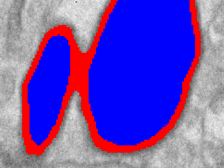 Visually Distinguishing Adjacent Myelin Wraps and Ellipse Minor Access ...