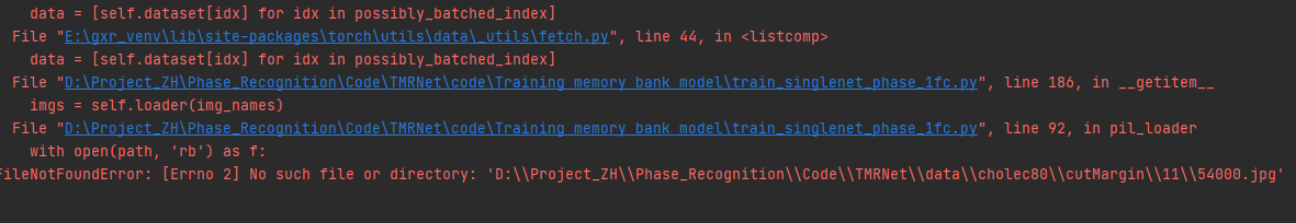 问题咨询 · Issue #2 · YuemingJin/TMRNet · GitHub