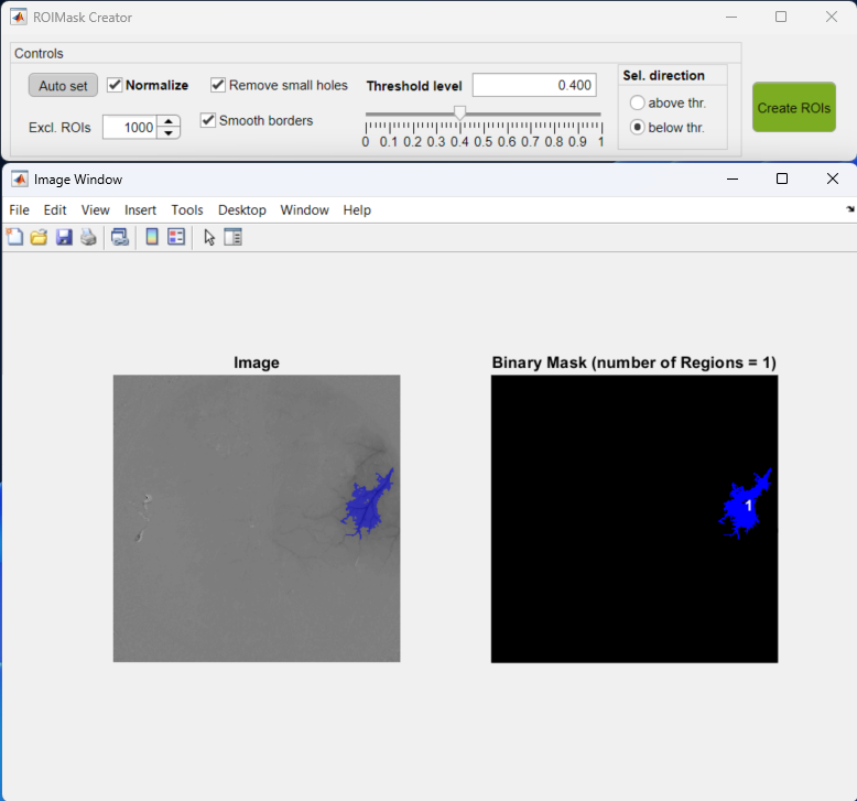 size of activation · LabeoTech Umit · Discussion #58 · GitHub