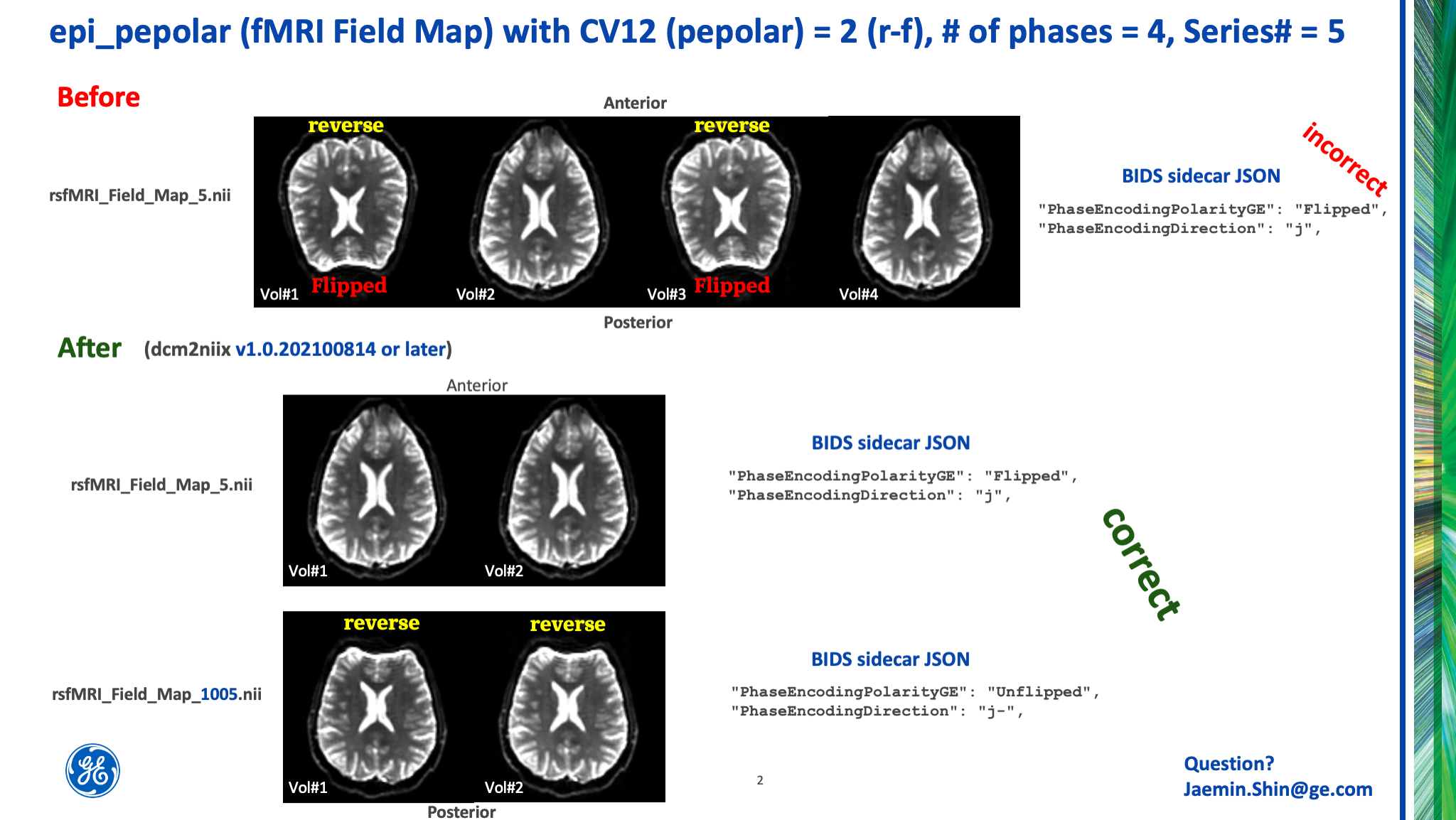 GE ABCD epi_pepolar sequence · Issue #532 · rordenlab/dcm2niix · GitHub