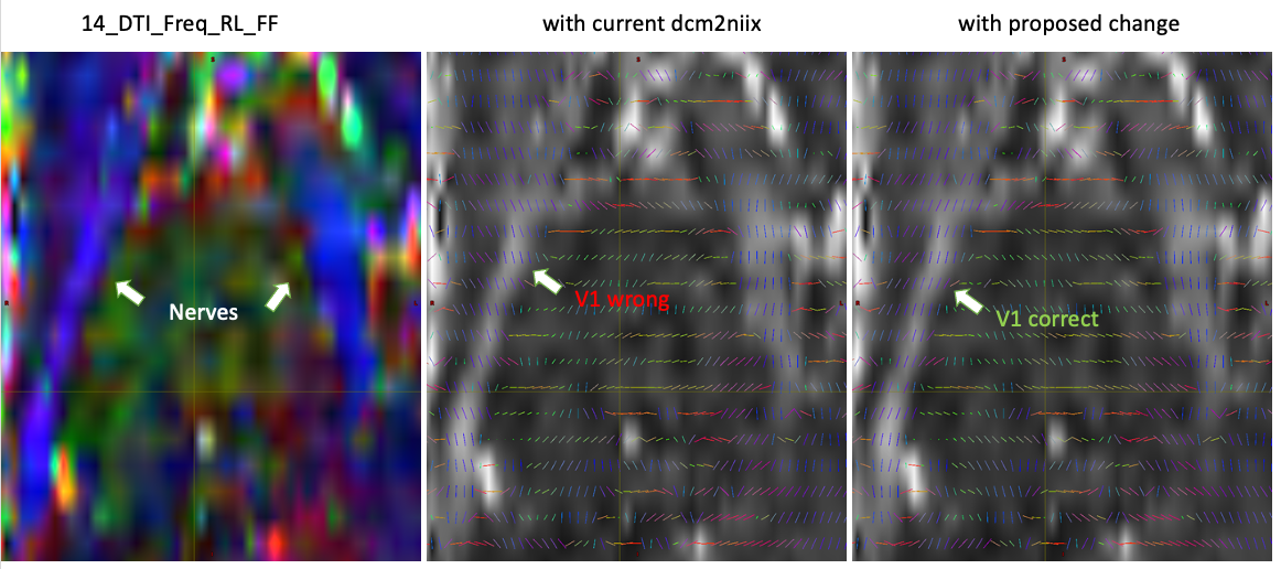 GE non-HFS DTI · Issue #737 · rordenlab/dcm2niix · GitHub