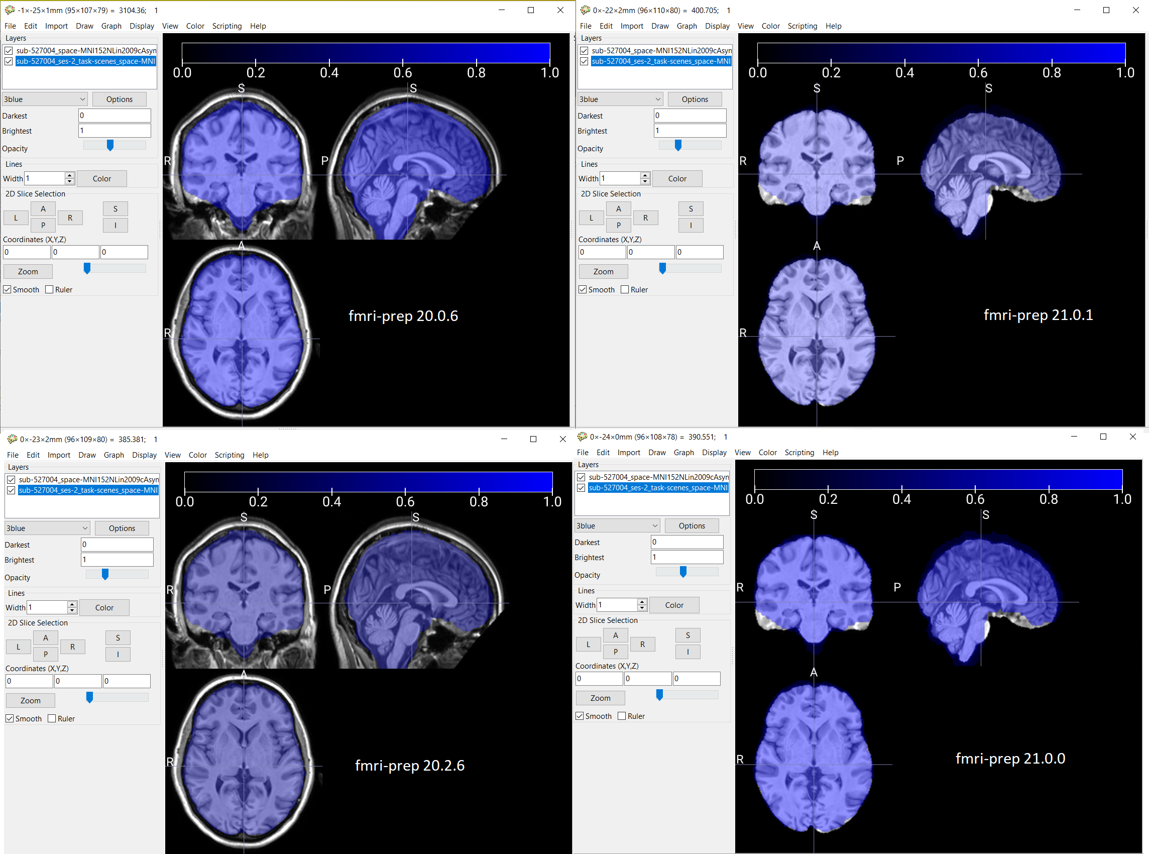 Poor brain mask alignment into anatomical space · Issue #2765 · nipreps/fmriprep · GitHub