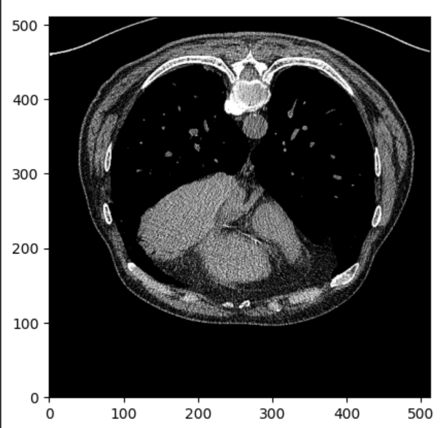 GitHub - Nandita10062001/Medical-Image-Analysis: Medical Image Analysis ...