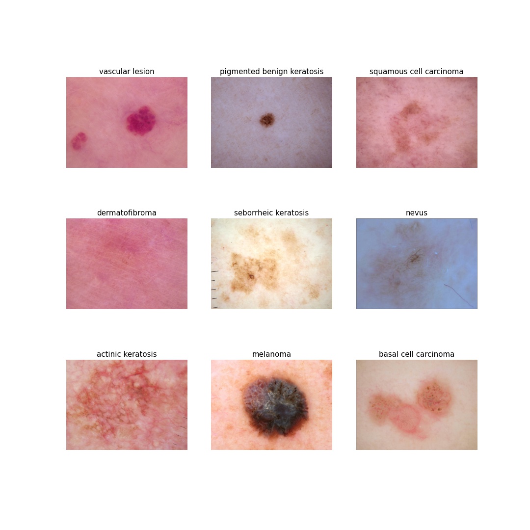GitHub - anurag-singh2001/skin-cancer-detection-project