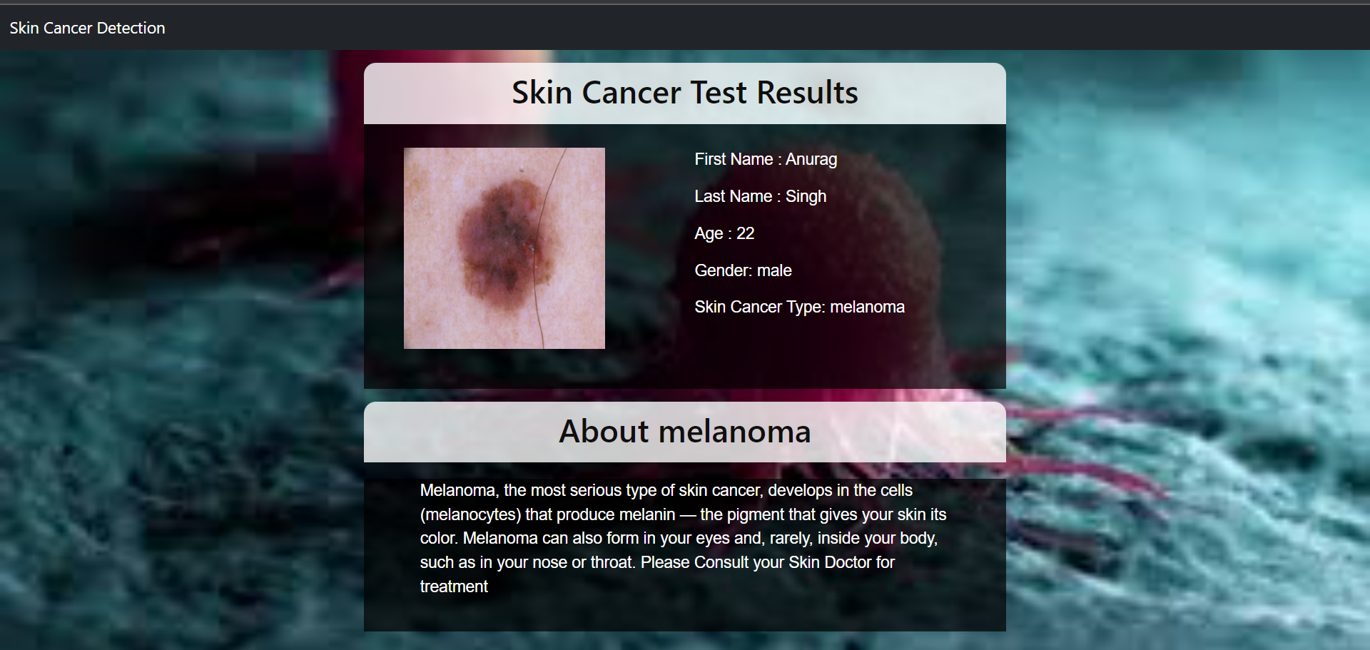 Github Anurag Singh2001 Skin Cancer Detection Project