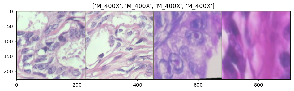 GitHub - mustafashalata/Breast-Cancer-Classification