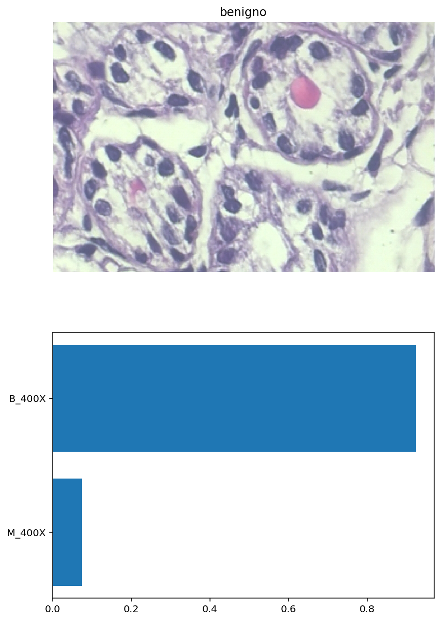 GitHub - iMahmouddAli/Breast-Cancer-Classification