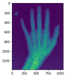 GitHub - mustafashalata/bone-age-prediction