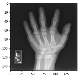 GitHub - mustafashalata/bone-age-prediction