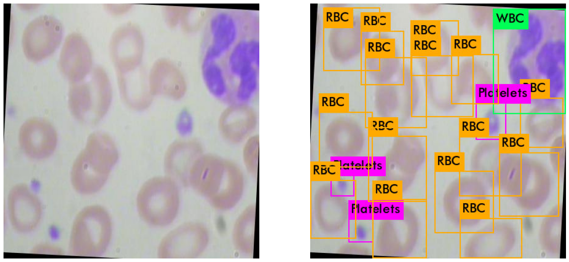 GitHub - mustafashalata/blood-cells-detection