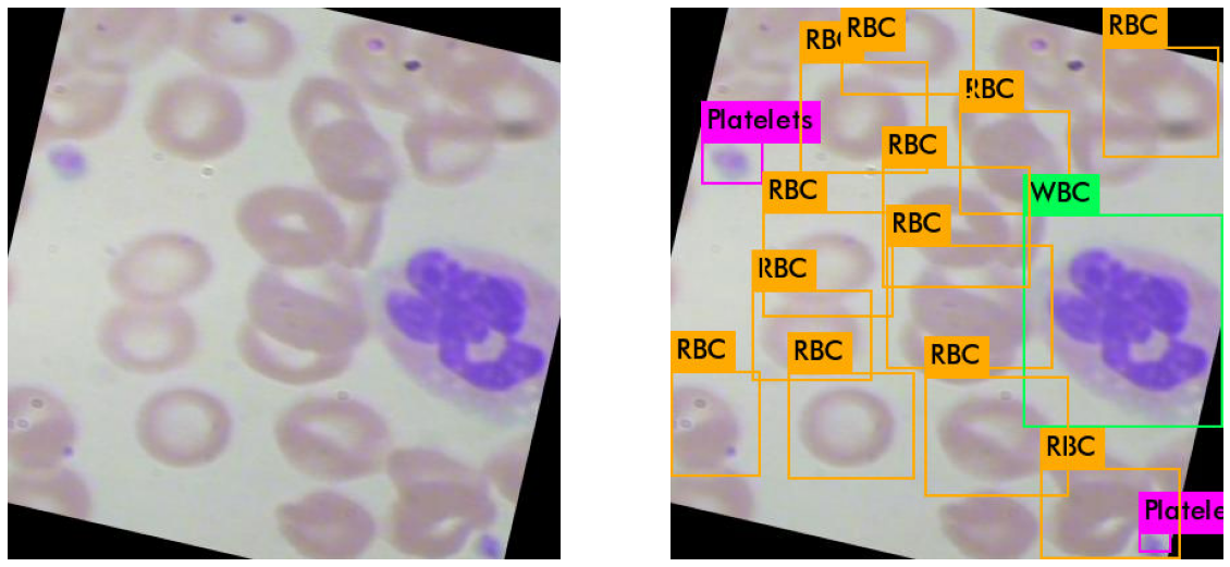 GitHub - mustafashalata/blood-cells-detection