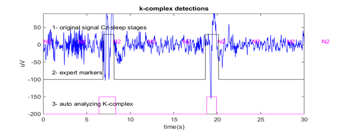 GitHub - MaryMahmoodi/polysomnography-PSG-sleep-autoanalysis