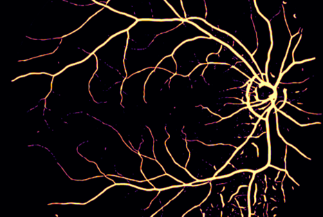 GitHub - MaksimLik/Segmenting-Retinal-Blood-Vessels-With-AI: Detection of the retinal fundus ...