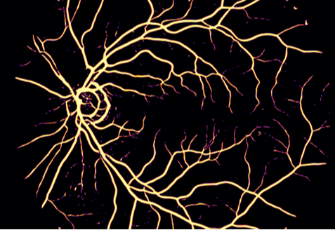 GitHub - MaksimLik/Segmenting-Retinal-Blood-Vessels-With-AI: Detection ...