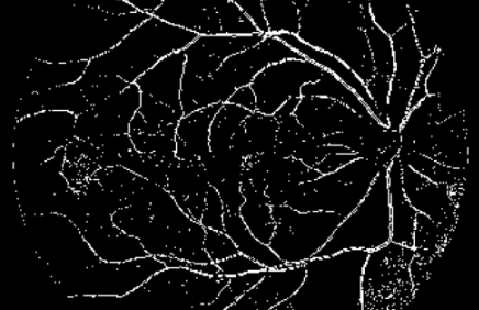 GitHub - MaksimLik/Segmenting-Retinal-Blood-Vessels-With-AI: Detection ...