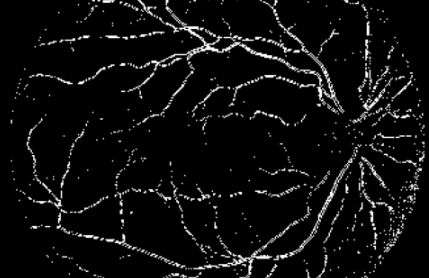 GitHub - MaksimLik/Segmenting-Retinal-Blood-Vessels-With-AI: Detection ...