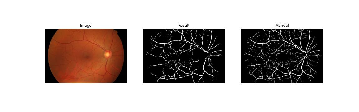 GitHub - WojtiStudent/Segmenting_Retinal_Blood_Vessels