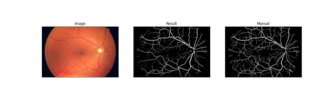GitHub - WojtiStudent/Segmenting_Retinal_Blood_Vessels