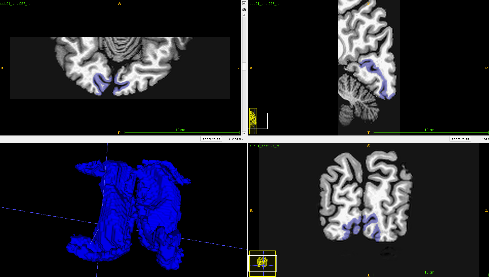 Resampling binary masks · Issue #1296 · ANTsX/ANTs · GitHub