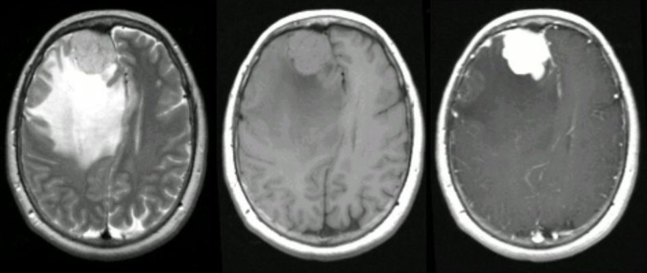 GitHub - CharviGulati/FloodFill: Flood fill algorithm implementation ...