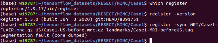 register tools segmentation fault all the time · Issue #115 · BIC-MNI ...