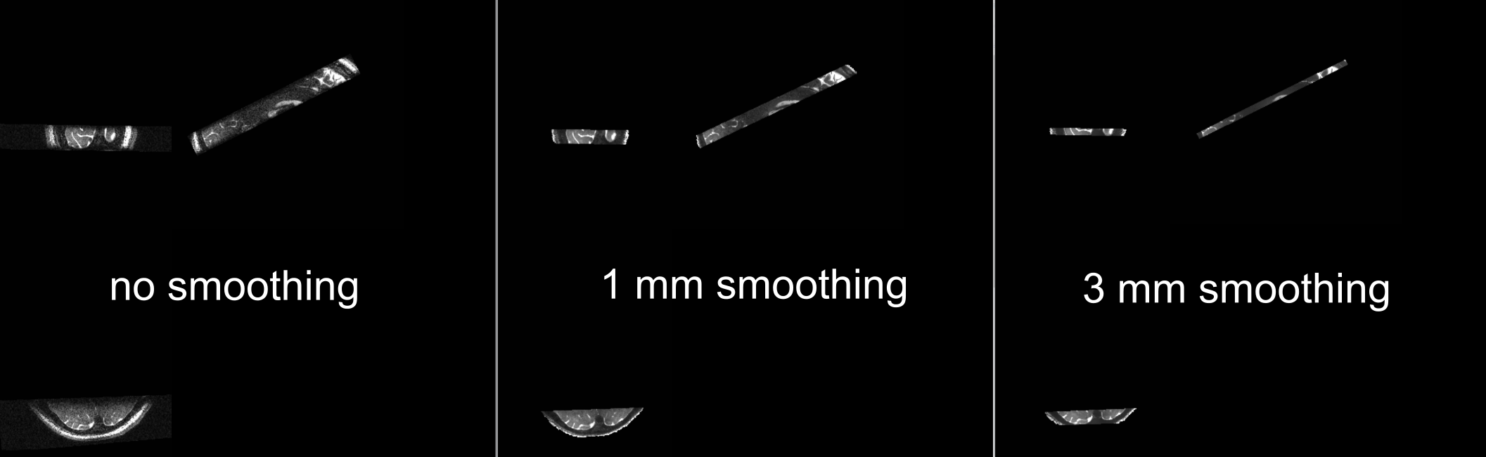 Volume cropping with LN_GRADSMOOTH proportional to smoothing fwhm · Issue #29 · layerfMRI/LAYNII ...