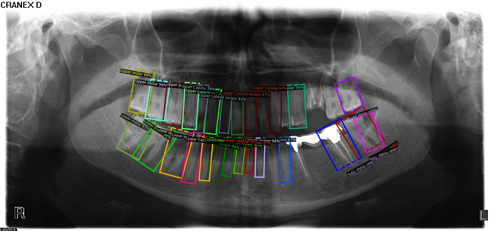 GitHub - Data-Driven-User-Analysis-Laboratory/Object-Detection-for-Teeth-X-ray-Image