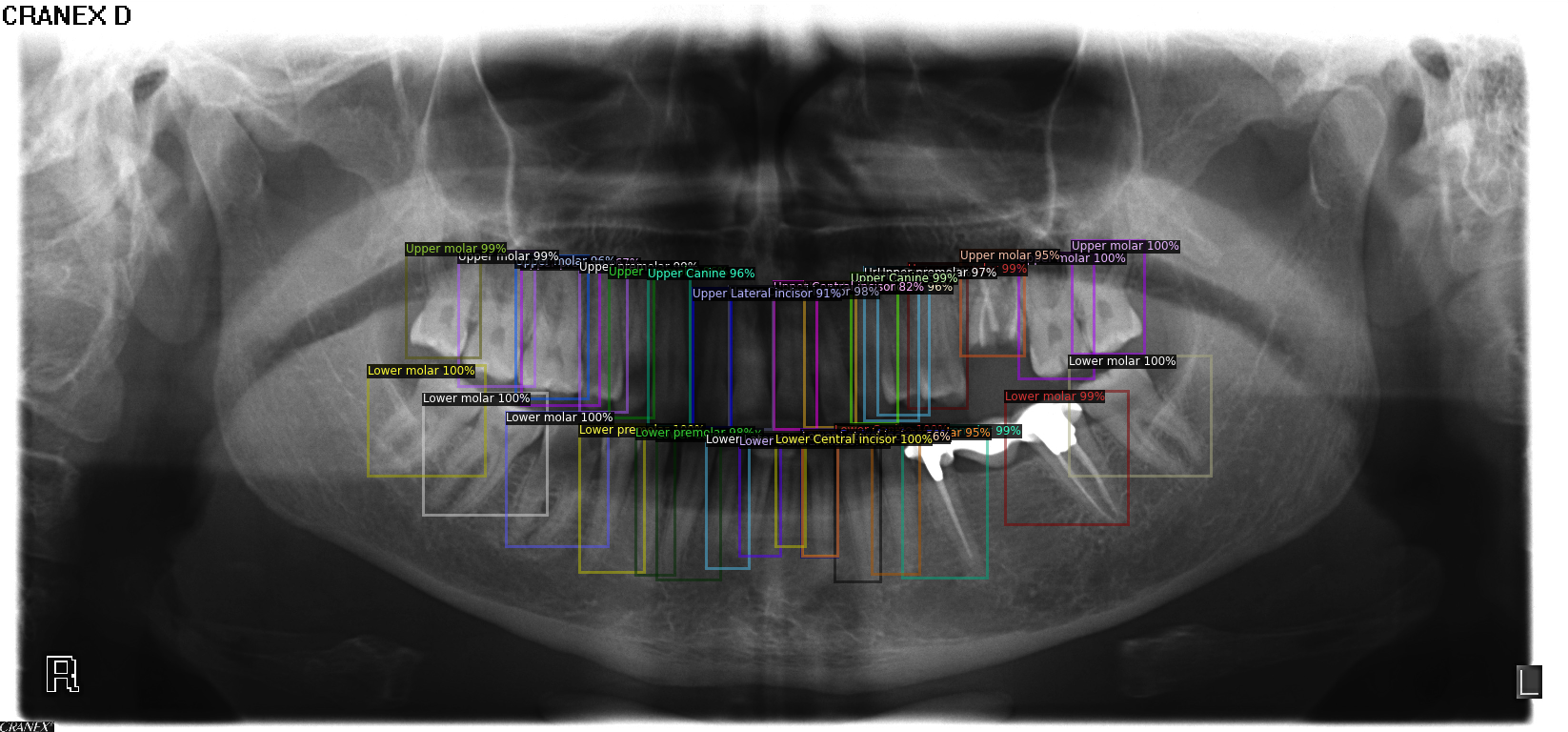 GitHub - Data-Driven-User-Analysis-Laboratory/Object-Detection-for ...