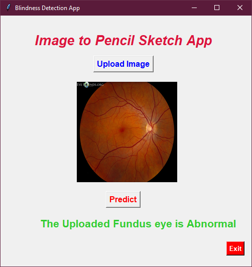 GitHub - Furkansayyed/Blindness_Detector_python