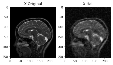 GitHub - ChicagoPark/MRI-Reconstruction