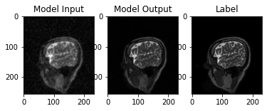 GitHub - ChicagoPark/MRI-Reconstruction