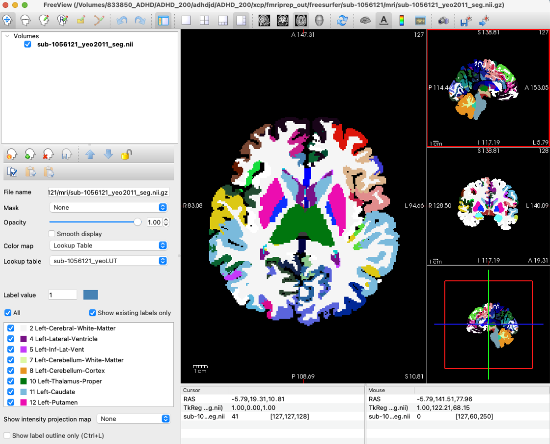 antsCorticalThickness Output · Issue #1527 · ANTsX/ANTs · GitHub