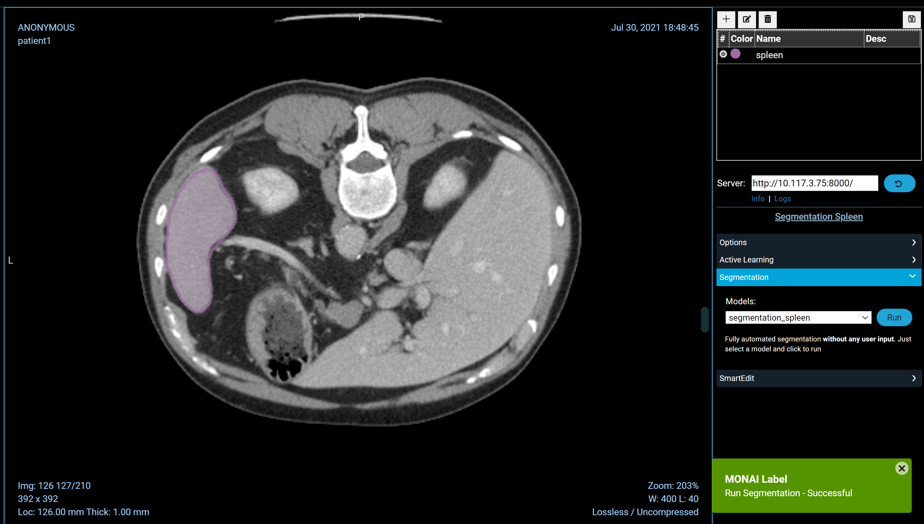 Ohif Auto Segmentation · Issue 234 · Project Monai Monailabel · Github